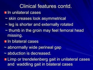 Developmental Dysplasia Of Hip | PPT