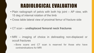 Fracture neck of femur | PPTX