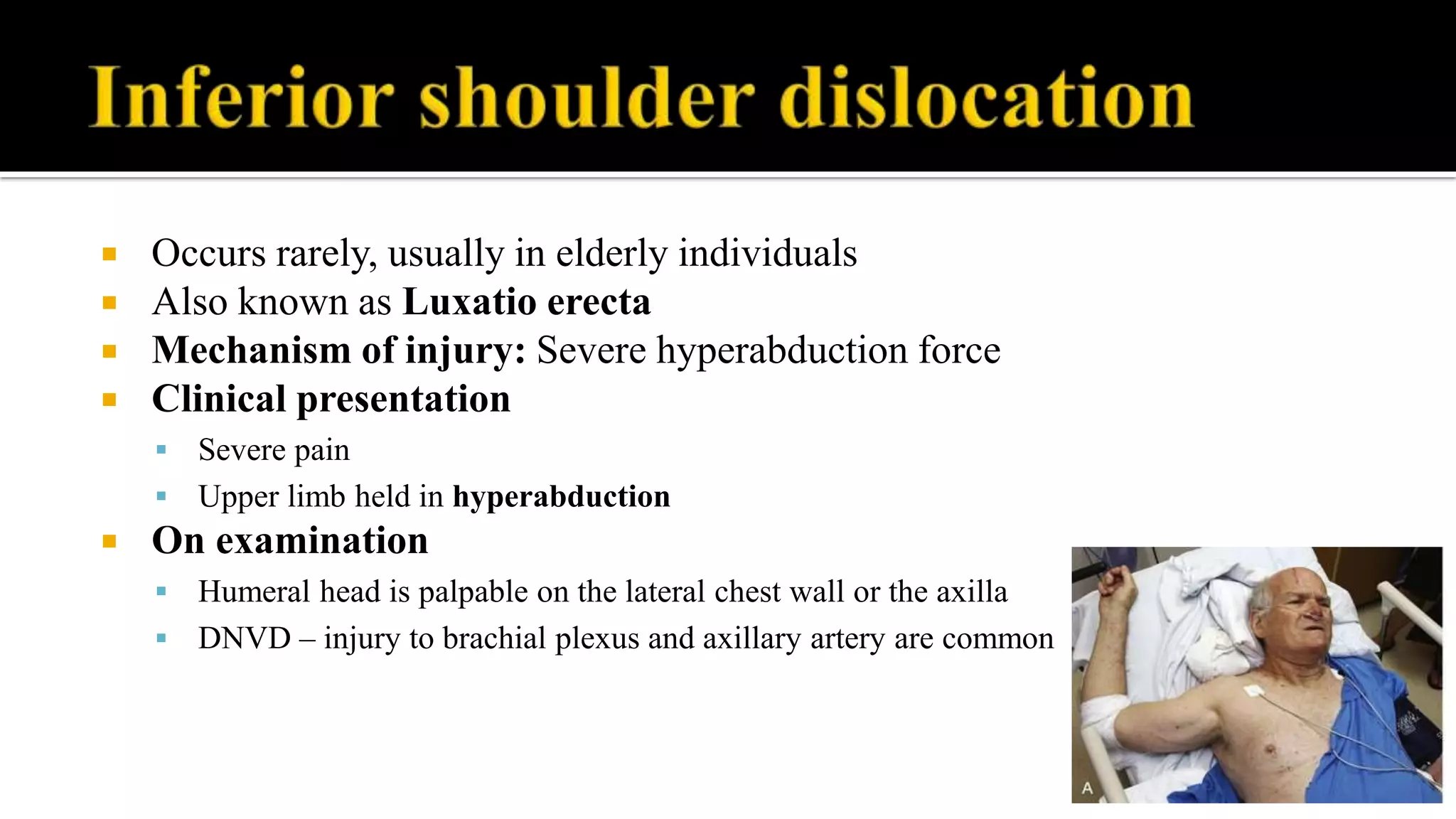 Shoulder dislocation | PPTX