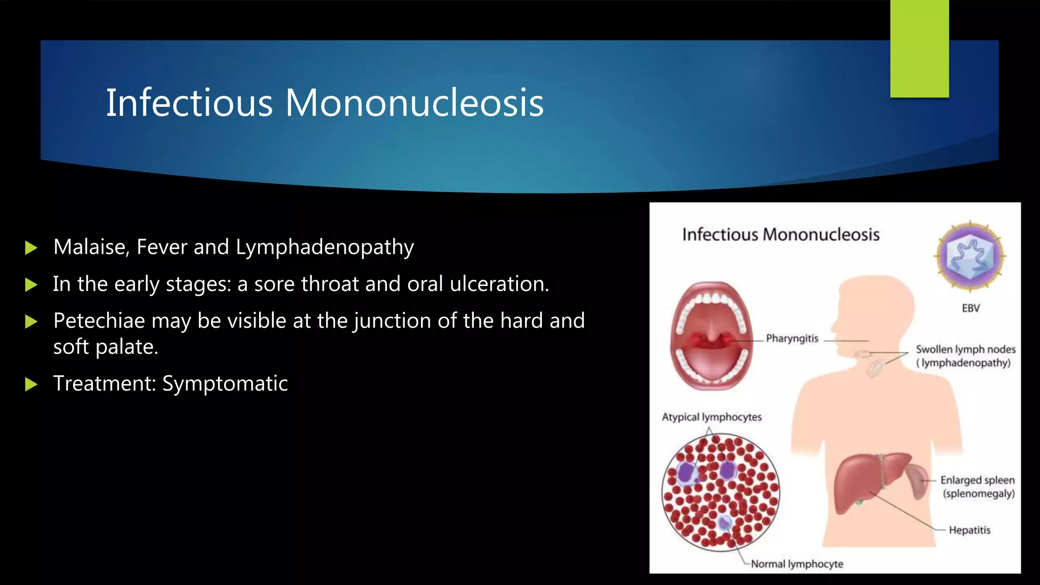 Viral Infections of Oral Mucosa | PPTX