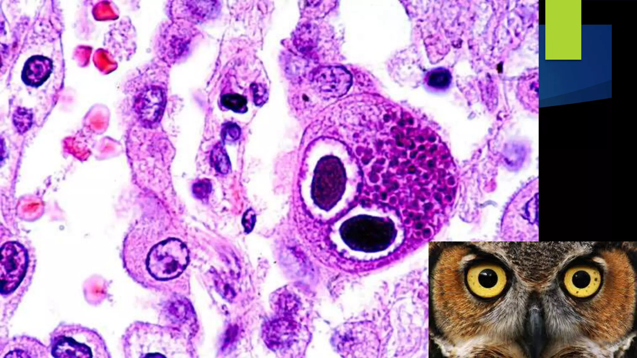 Viral Infections of Oral Mucosa | PPTX