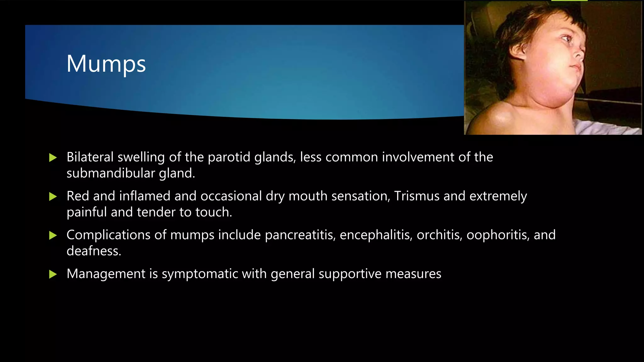 Viral Infections of Oral Mucosa | PPTX