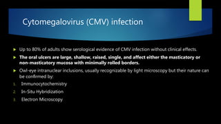 Viral Infections of Oral Mucosa | PPTX