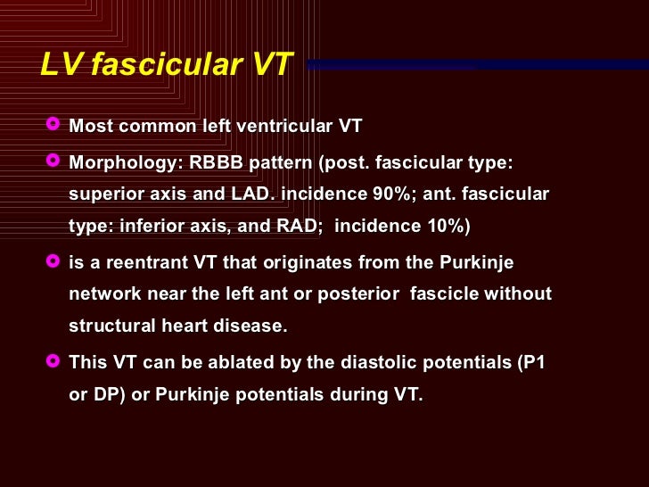 Catheter ablation of ventricular tachycardia