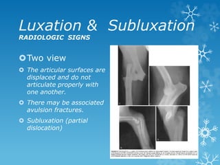 bone and joint1 | PPTX
