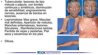 3. lepra | PPTX