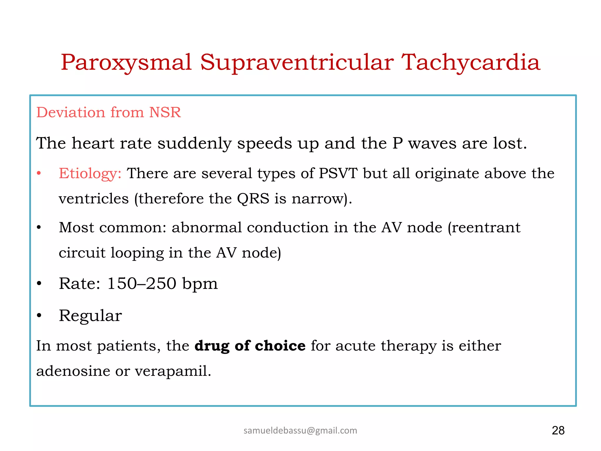 3. common cardiac arrythemias | PPTX