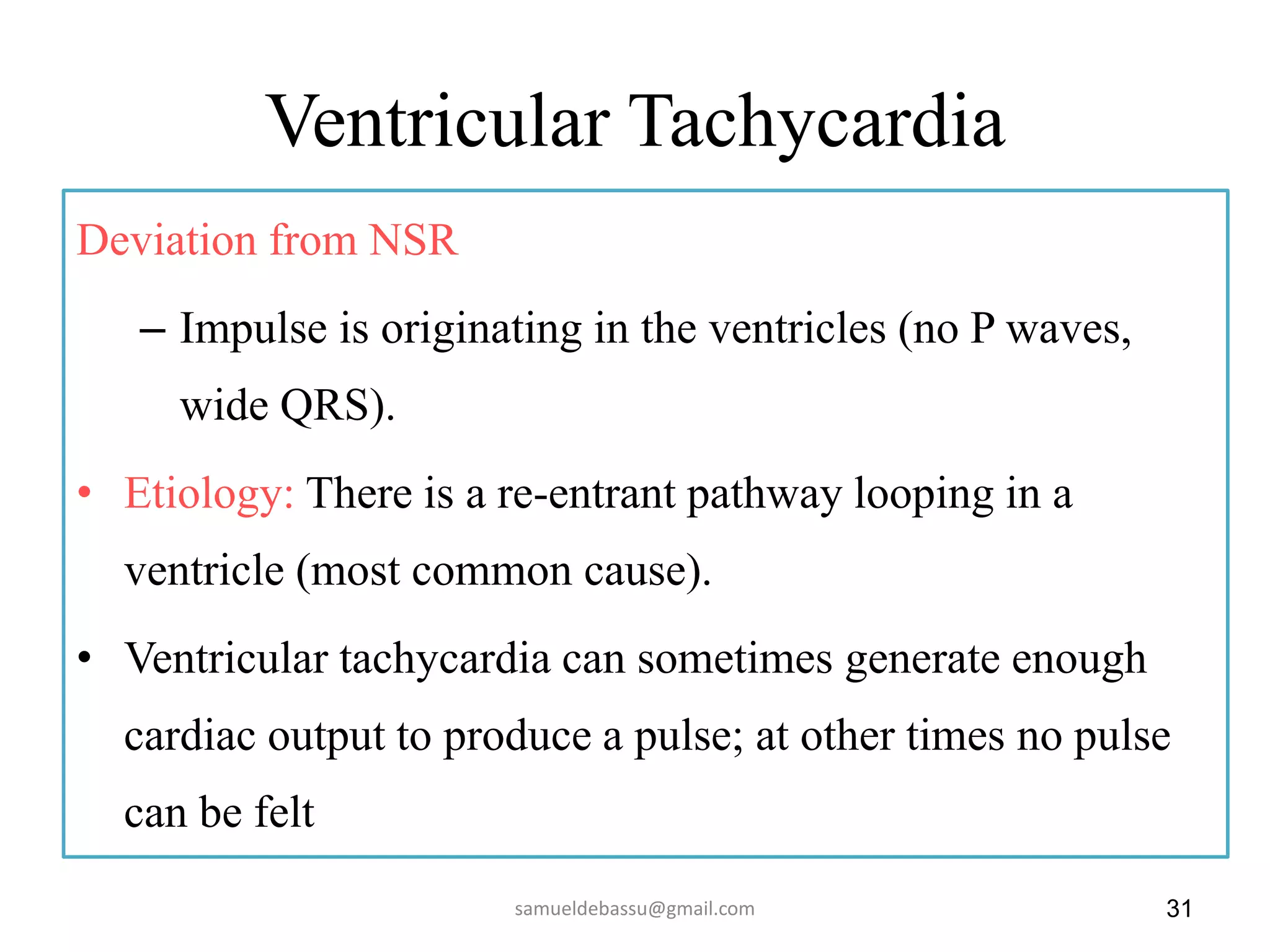 3. common cardiac arrythemias | PPTX