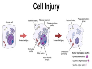 Cell Injury | PPTX