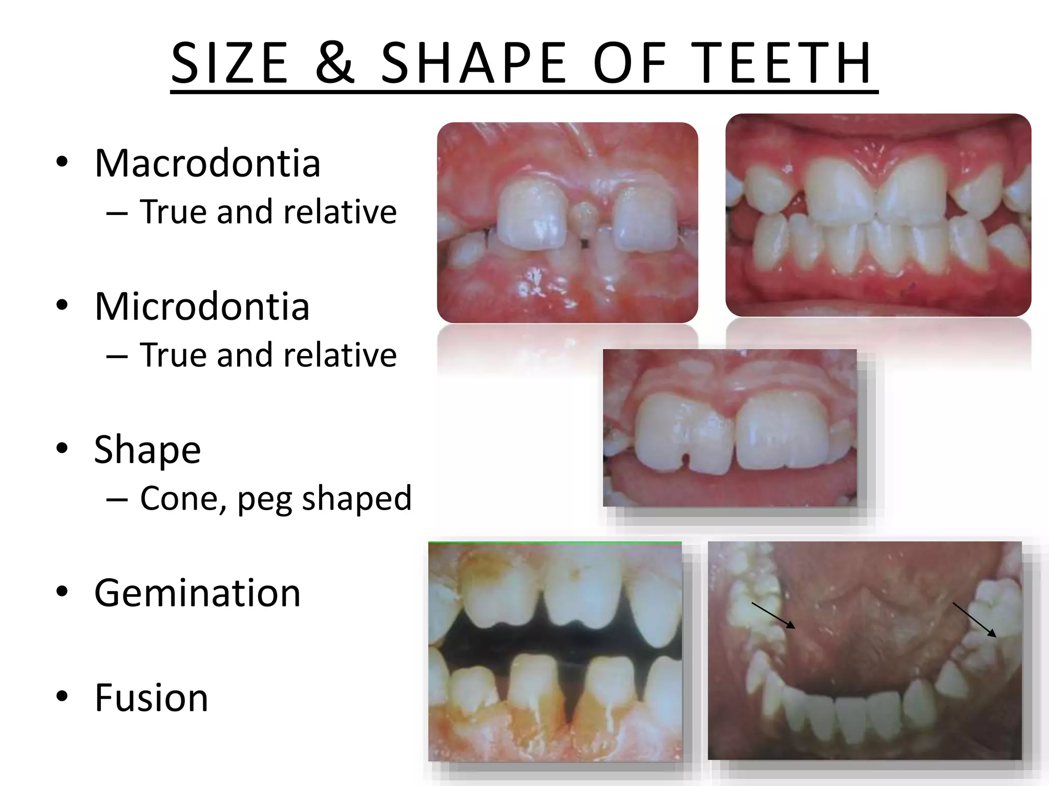 case history in paediatric dentistry | PPTX