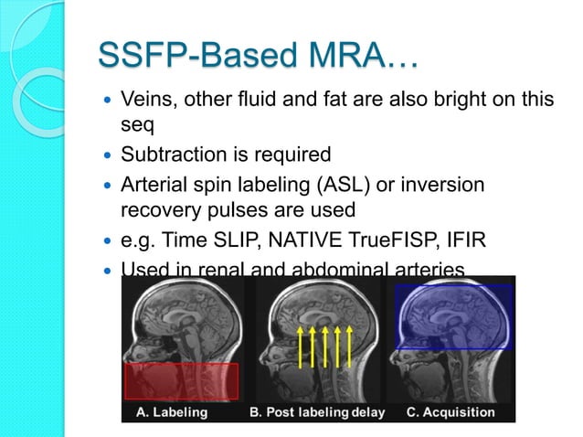 Steady State Free Precession MRA | PPTX
