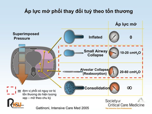 HỘI CHỨNG SUY HÔ HẤP CẤP NGUY KỊCH | PDF