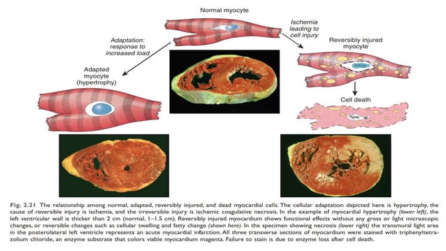3. cellular adaptations to stress | PPTX | Endocrine and Metabolic ...