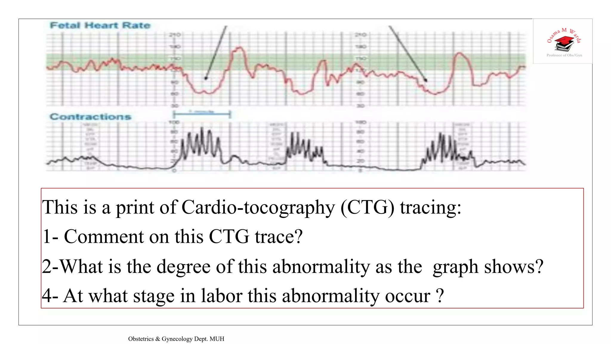 3.OBSTETRICS & GYNECOLOGY OSCE REVISION-3 | PDF