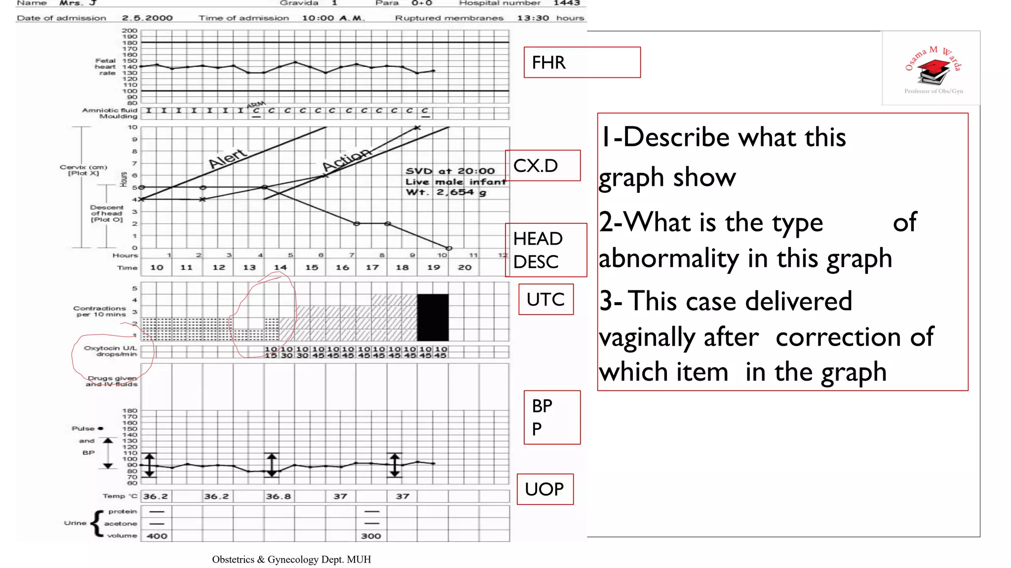 3.OBSTETRICS & GYNECOLOGY OSCE REVISION-3 | PDF