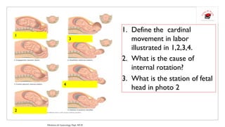 3.OBSTETRICS & GYNECOLOGY OSCE REVISION-3 | PDF