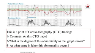3.OBSTETRICS & GYNECOLOGY OSCE REVISION-3 | PDF