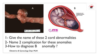 3.OBSTETRICS & GYNECOLOGY OSCE REVISION-3 | PDF