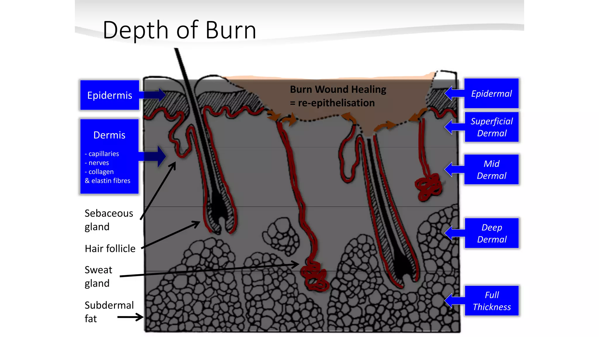 Surgical management of burn injuries | PPTX