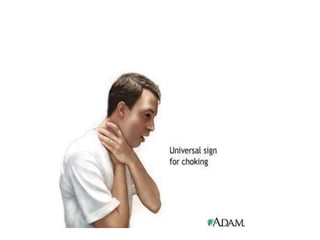 3. የአየርቱቦመዘጋት (choking) | PPTX