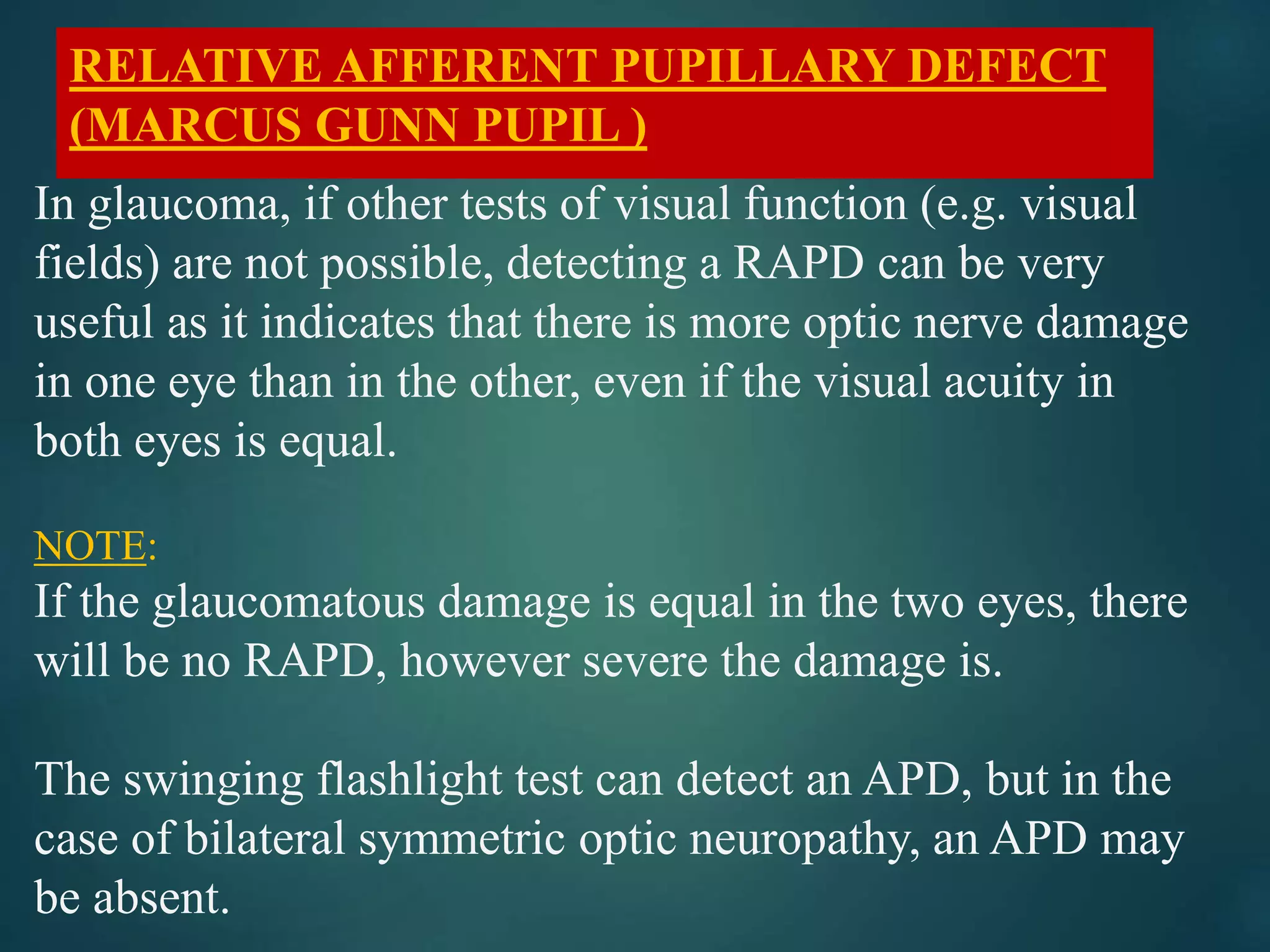 3.ophthalmology workup.3 | PPTX