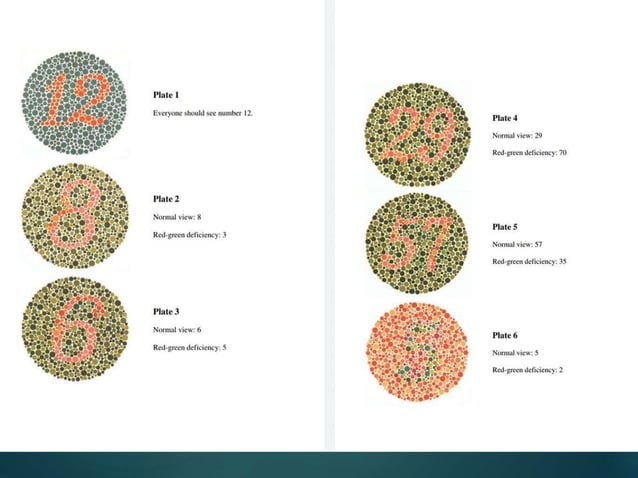 3.ophthalmology workup.3 | PPT