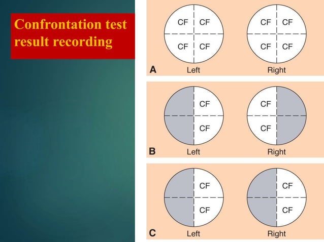 3.ophthalmology workup.3 | PPT