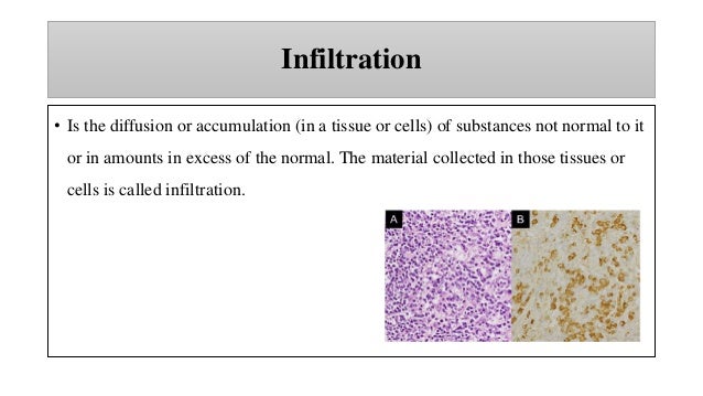 3..infiltration & regeneration | PPTX