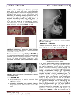 Impacted Maxillary Central Incisors: Surgical Exposure and Orthodontic ...