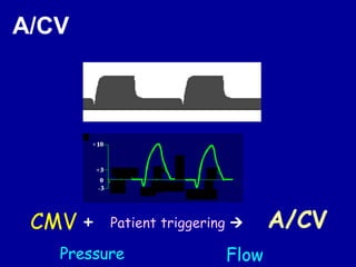 3.4.Conventional modes SIMV PSV PEEP, CPAP, IRV.ppt