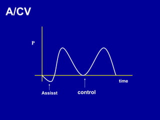 3.4.Conventional modes SIMV PSV PEEP, CPAP, IRV.ppt