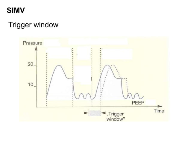 3.4.Conventional modes SIMV PSV PEEP, CPAP, IRV.ppt