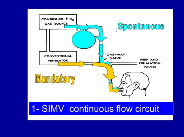 3.4.Conventional modes SIMV PSV PEEP, CPAP, IRV.ppt