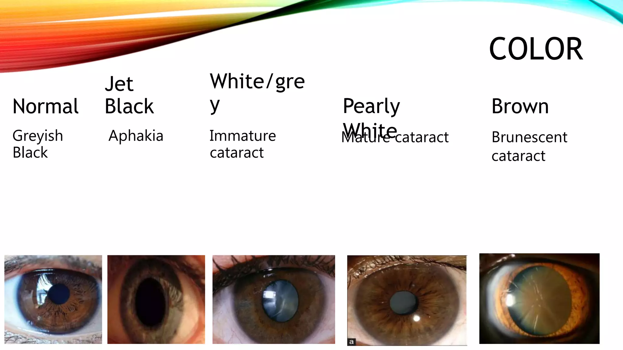 3. Pupil examination.pptx