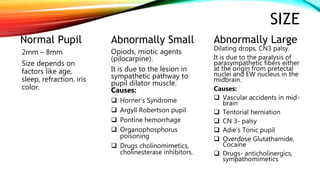 3. Pupil examination.pptx | Eye and Vision Conditions | Diseases and ...