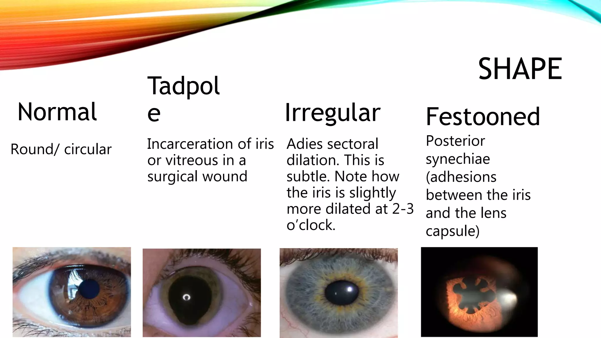 3. Pupil examination.pptx