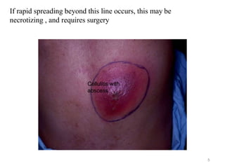 3. lec 4 integument system PATH-321.pptx