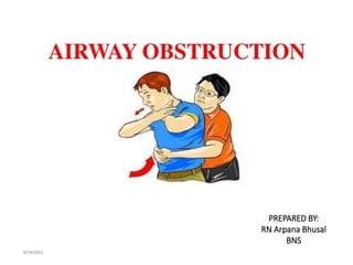 Airway obstruction | PPTX