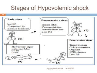 Hyovolemic shock | PPTX