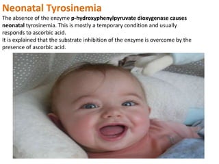 3.Metaboilsm of aminoacids.pptx