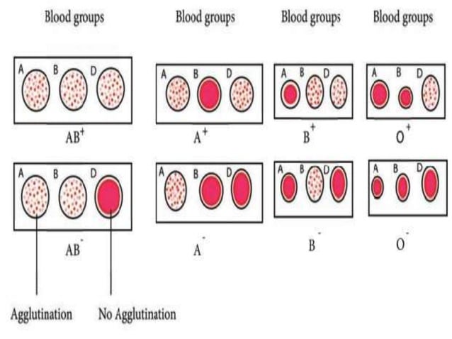 Hematopoietic system-Human Blood,blood grouping,blood clotting | PPT