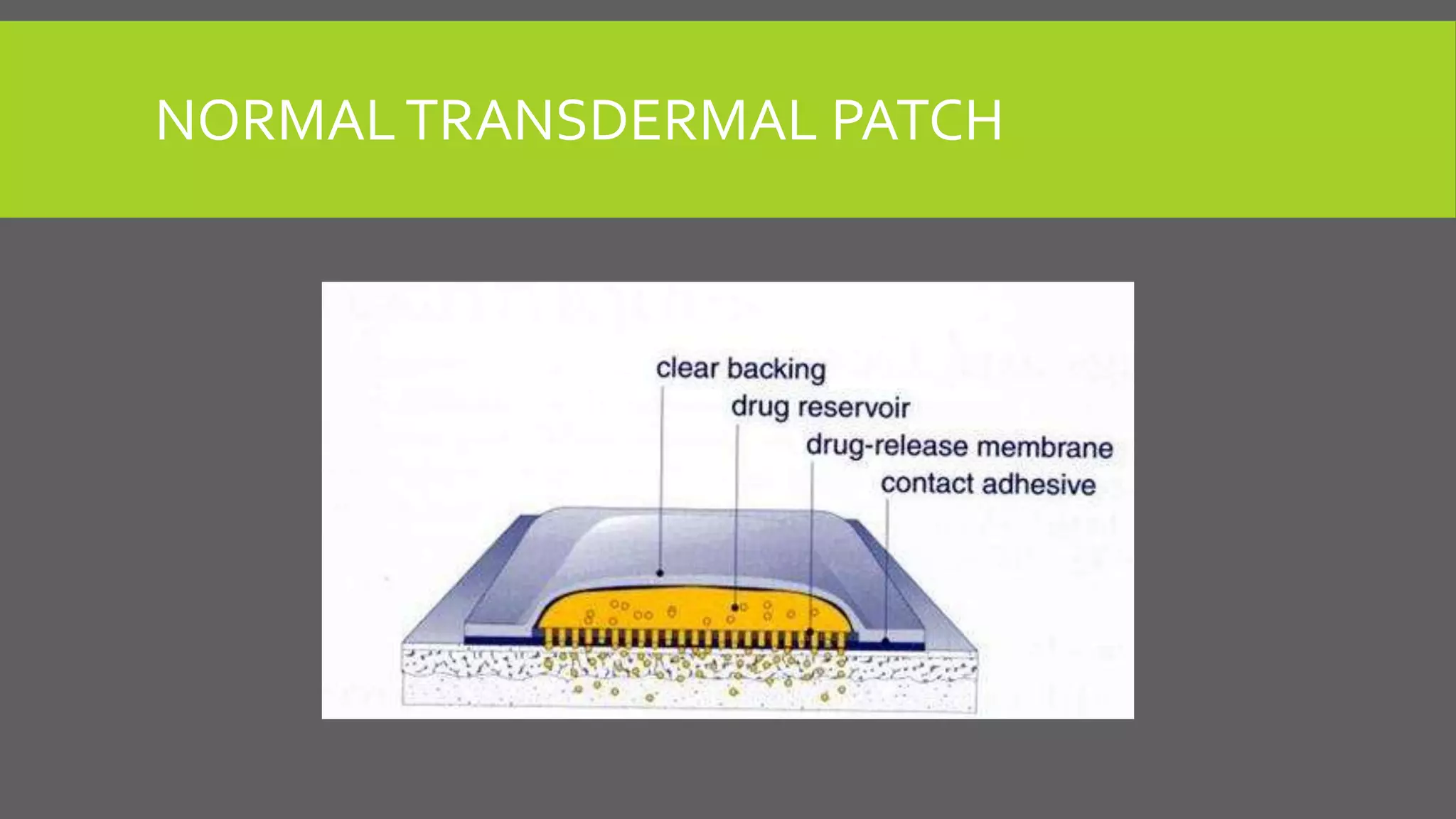 Transdermal drug delivery systems | PPT