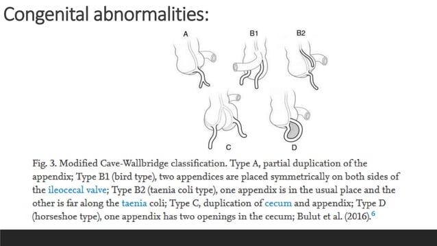 3. Appendix (Anatomy).pptx | Pregnancy | Reproductive Health