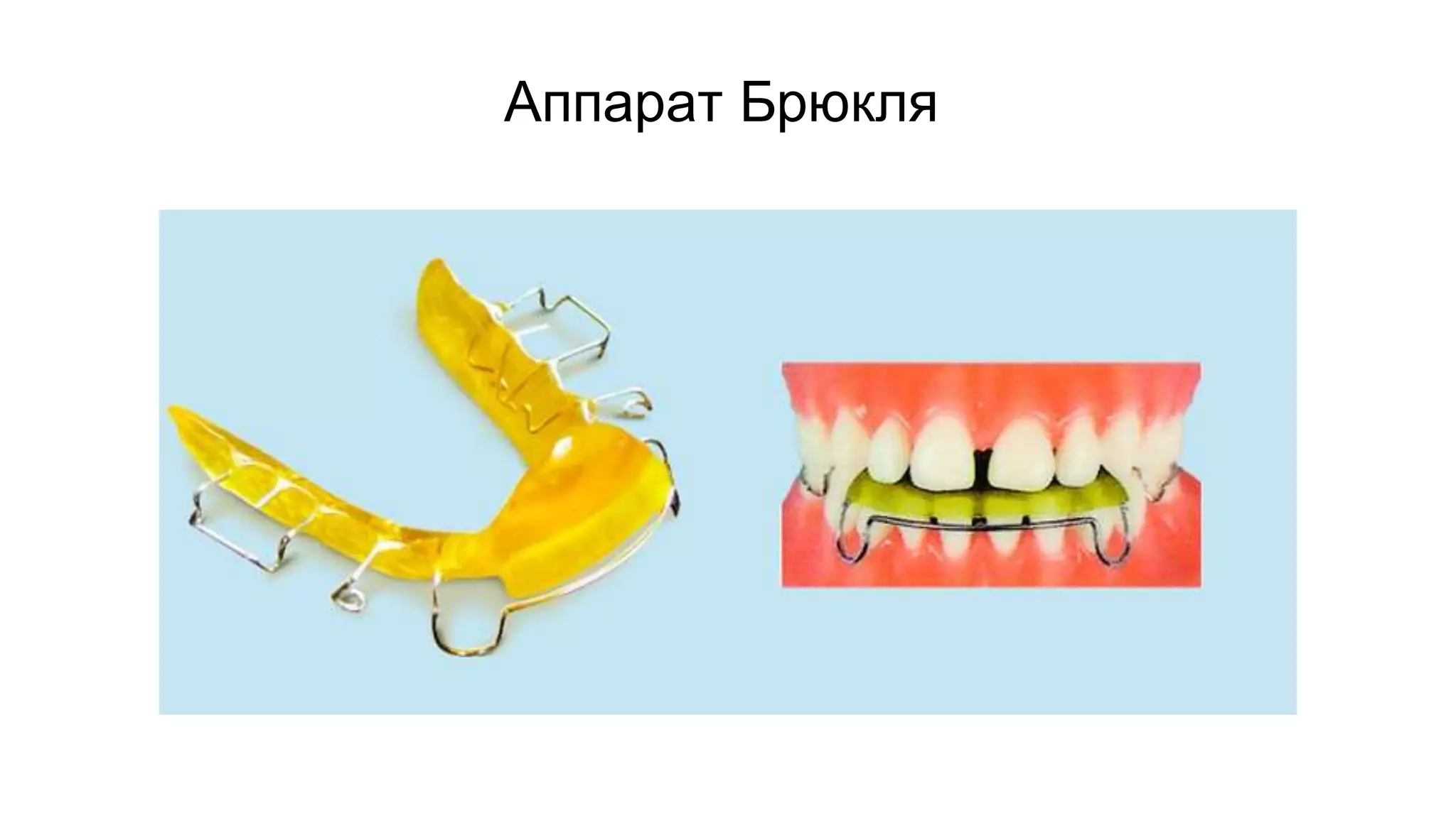 Аппараты 3.pptx