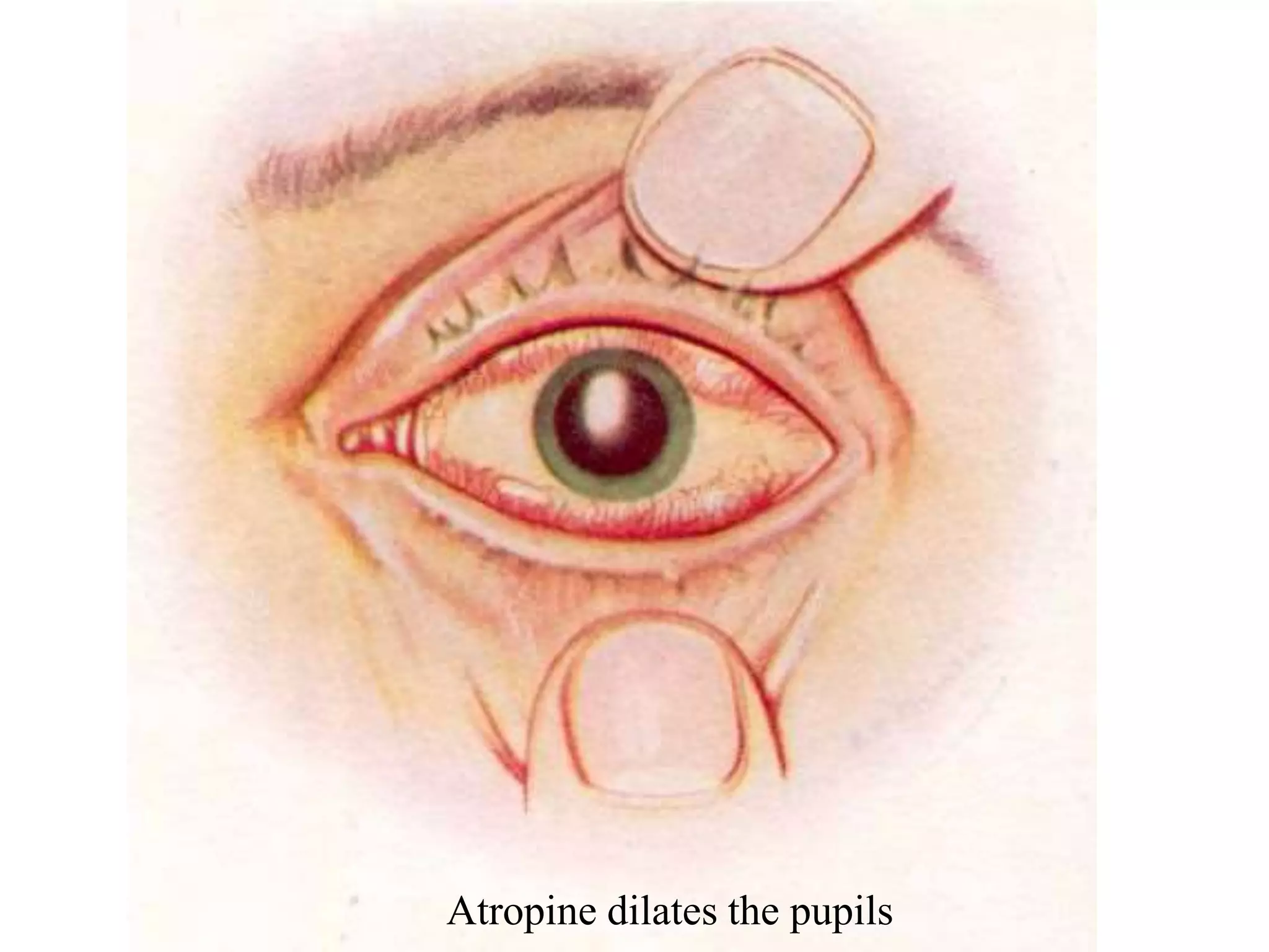 3._Atropine_poisoning.pptx