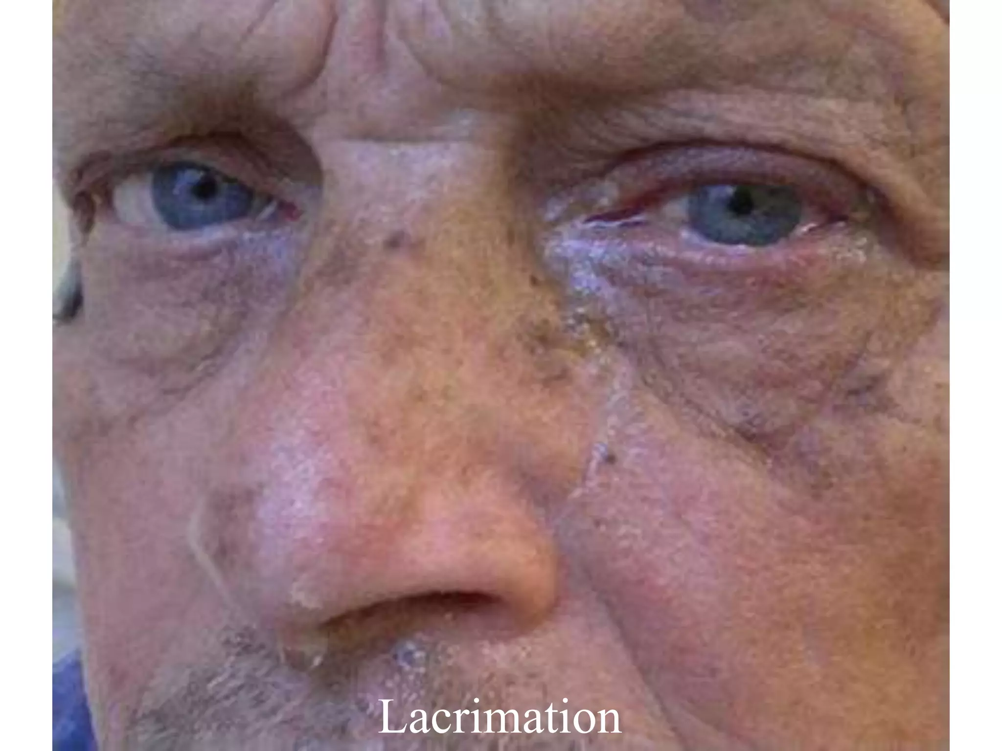 3._Atropine_poisoning.pptx