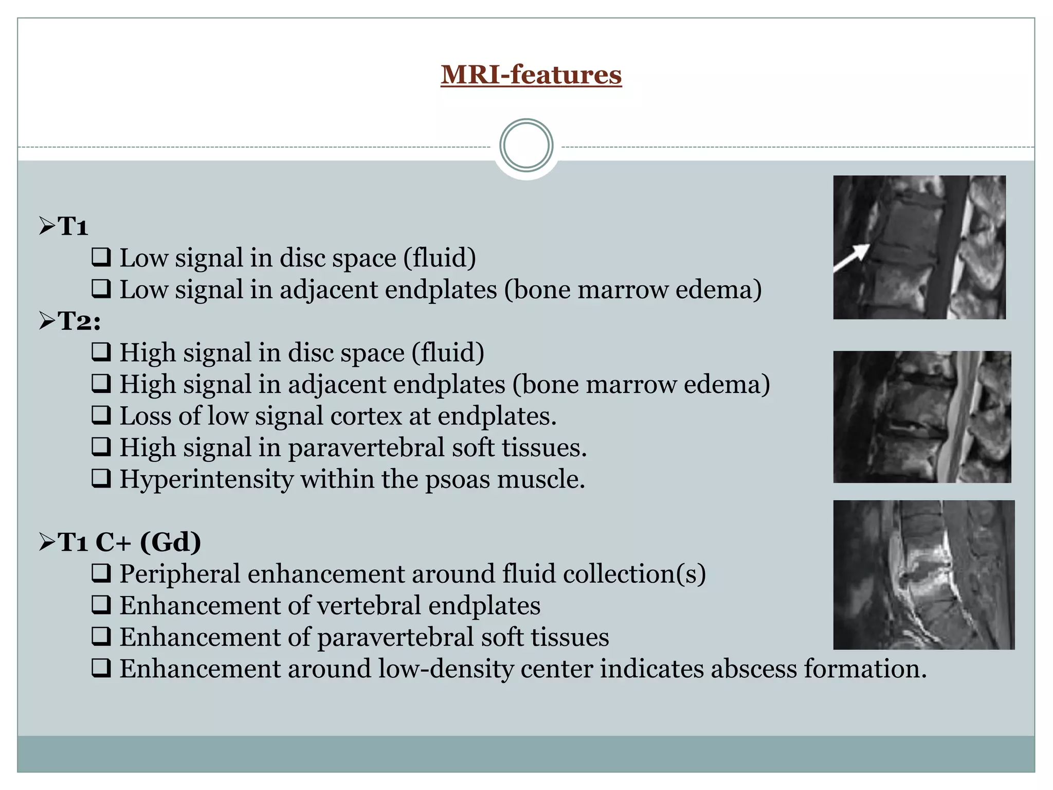 Spine disease rg evaluation.pdf