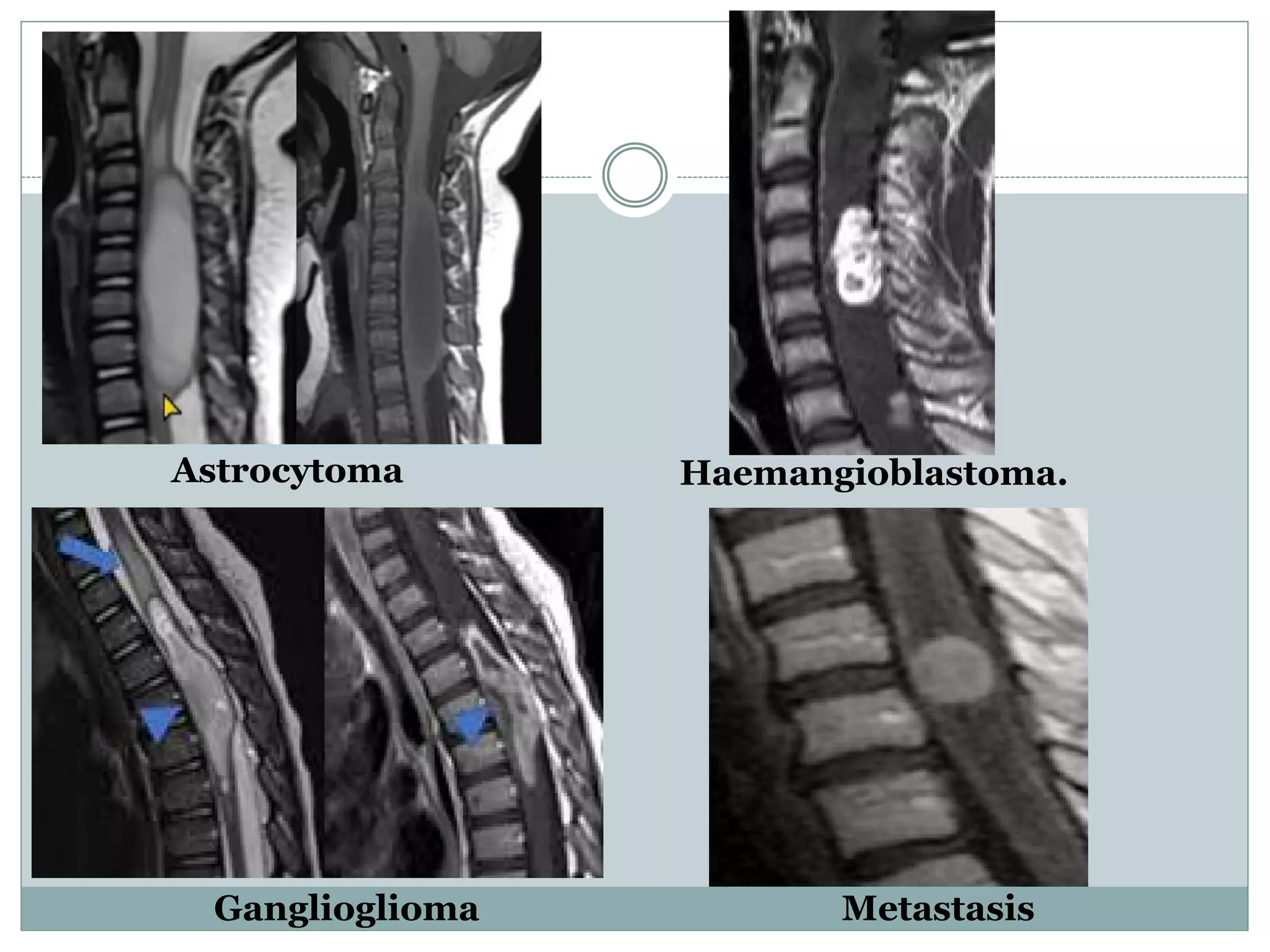 Spine disease rg evaluation.pdf