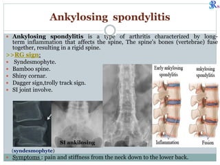 Spine disease rg evaluation.pdf