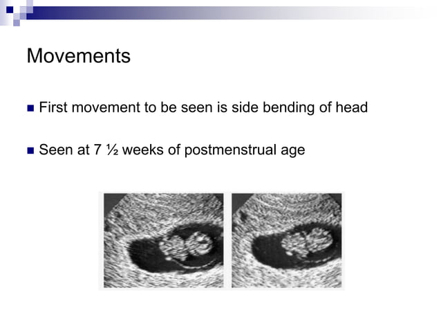 General movements.pptx